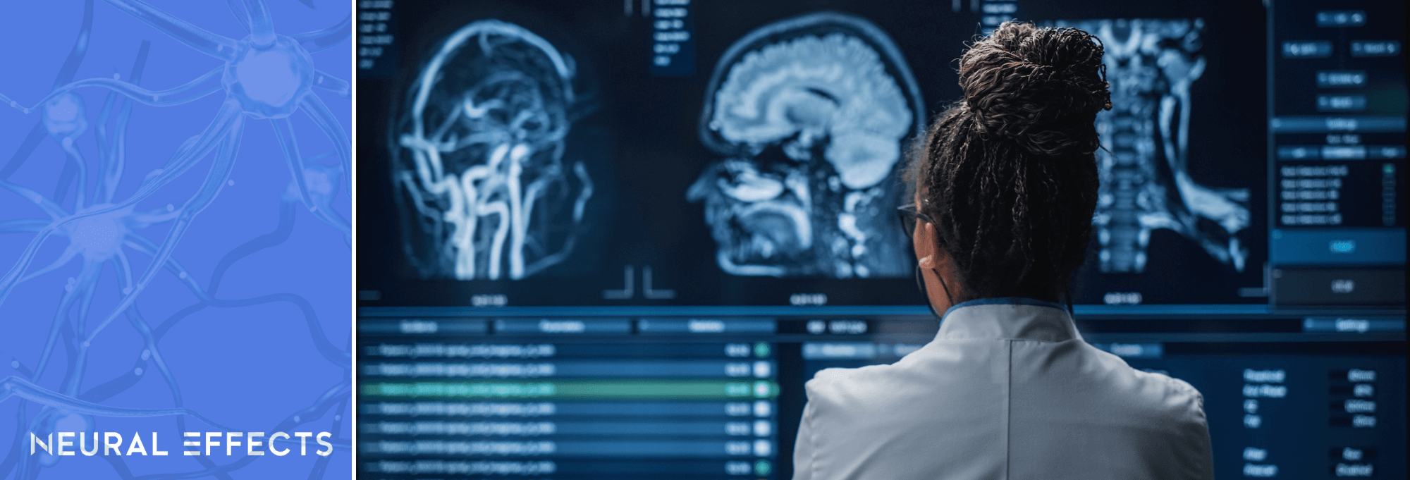 Neural Effects - Active Concussion Recovery Clinic in Utah